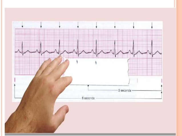 ECG (easy explanation) | PPTX | Heart and Cardiovascular Diseases ...