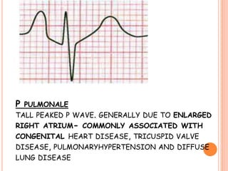 ECG (easy explanation) | PPTX