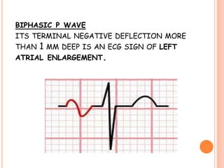ECG (easy explanation) | PPTX