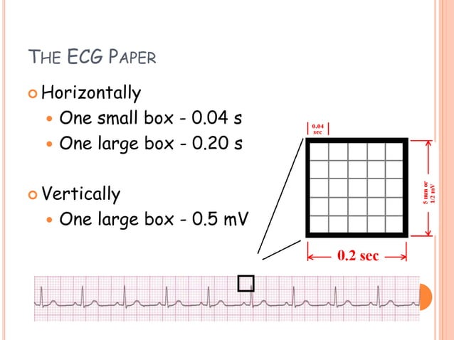 ECG (easy explanation) | PPTX | Heart and Cardiovascular Diseases ...