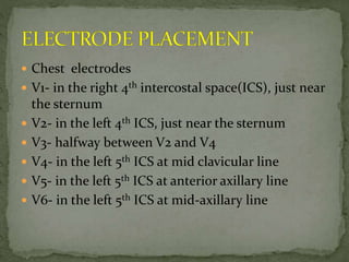 Ecg | PPT