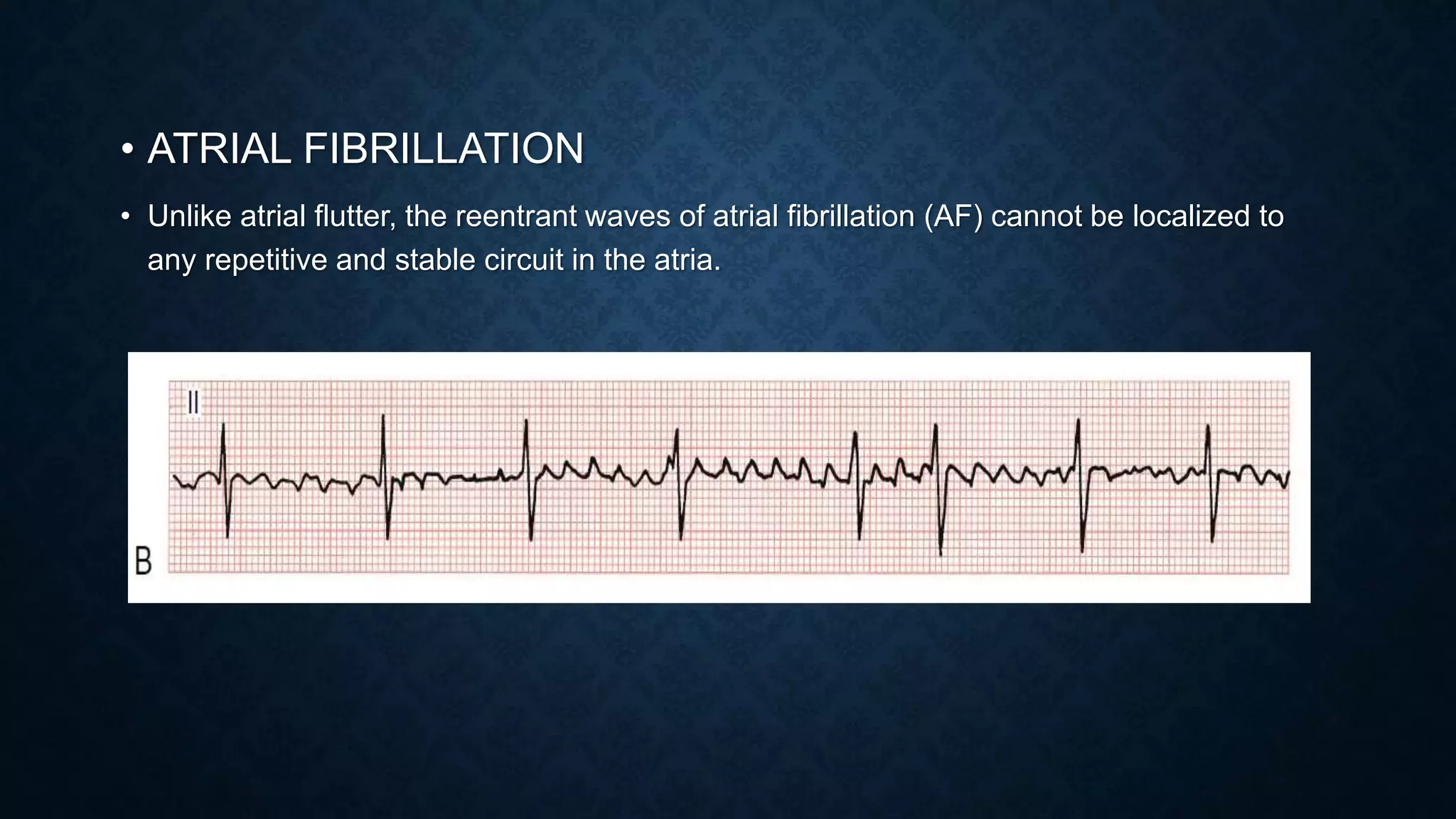 Ecg | PPTX