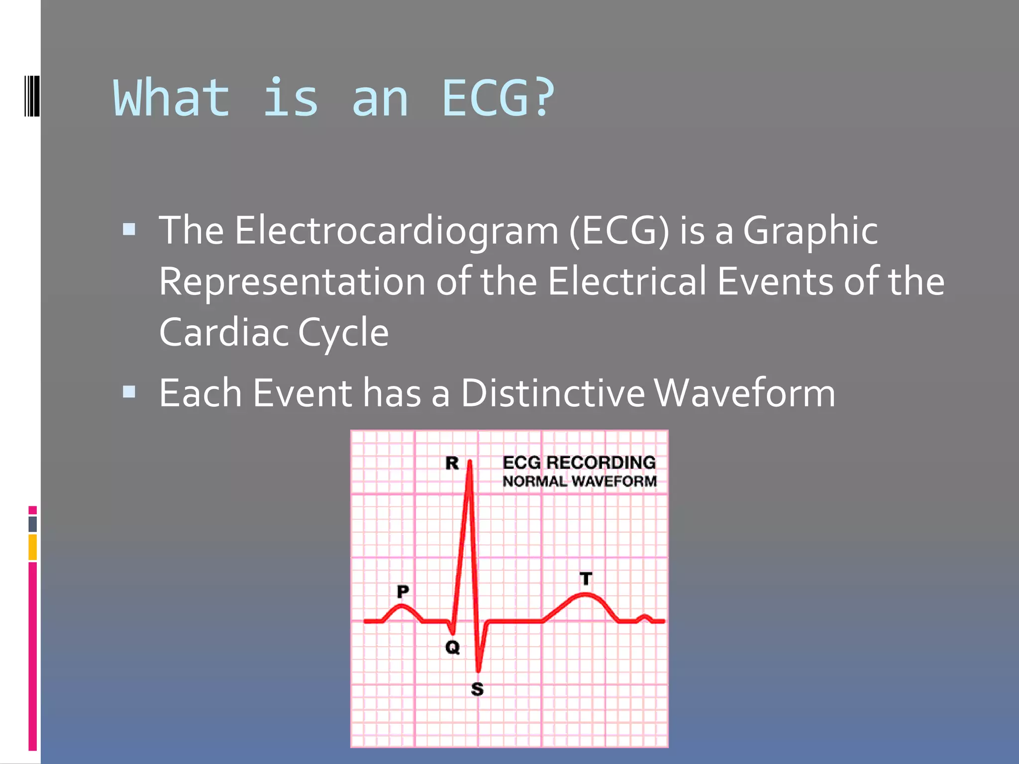 ECG | PPTX
