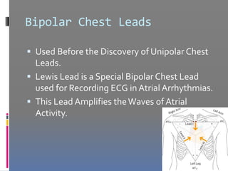 ECG | PPTX
