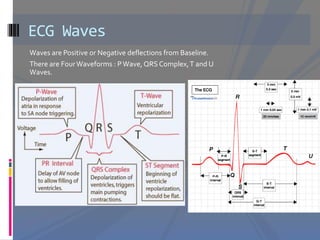 ECG | PPTX
