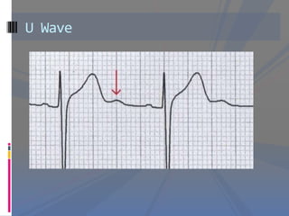 ECG | PPTX