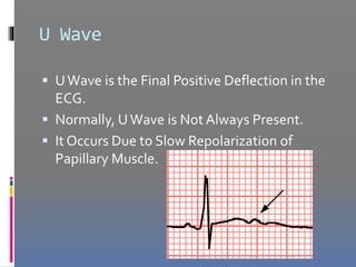 ECG | PPTX