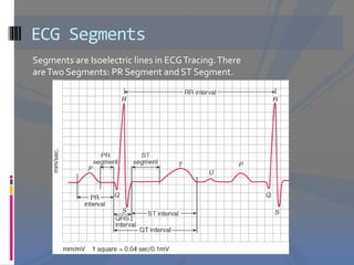 ECG | PPTX