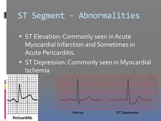 ECG | PPTX