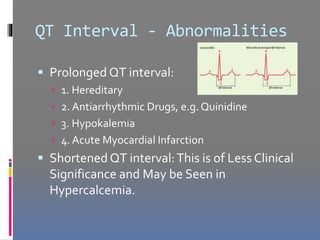 ECG | PPTX