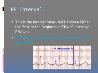 ECG | PPTX