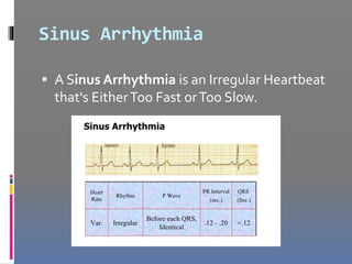 ECG | PPTX