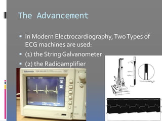 ECG | PPTX