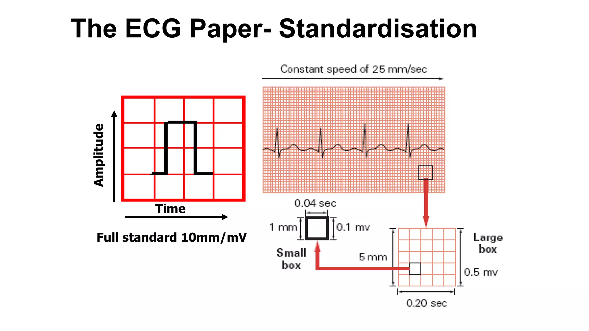 Ecg in children | PPTX