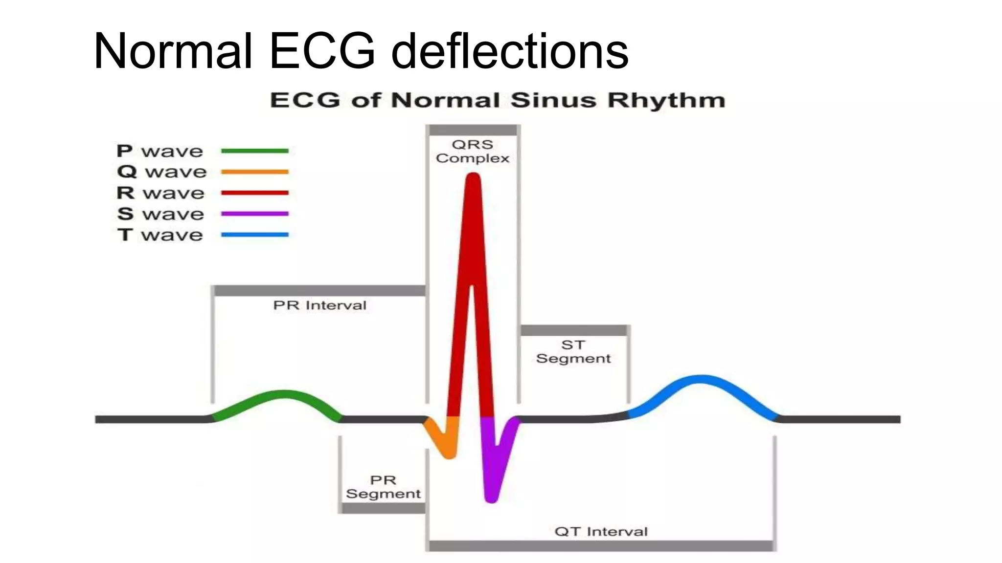 Ecg in children | PPTX