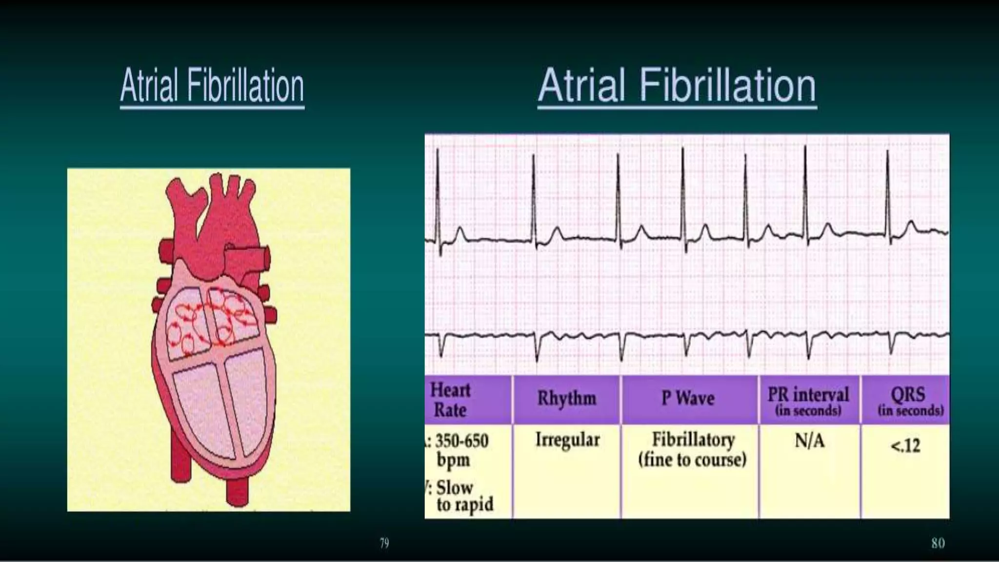 Ecg in children | PPTX