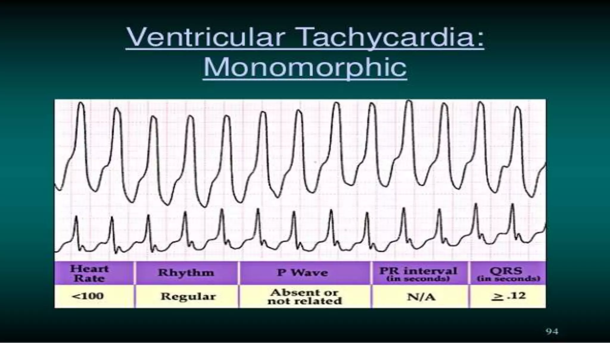 Ecg in children | PPTX