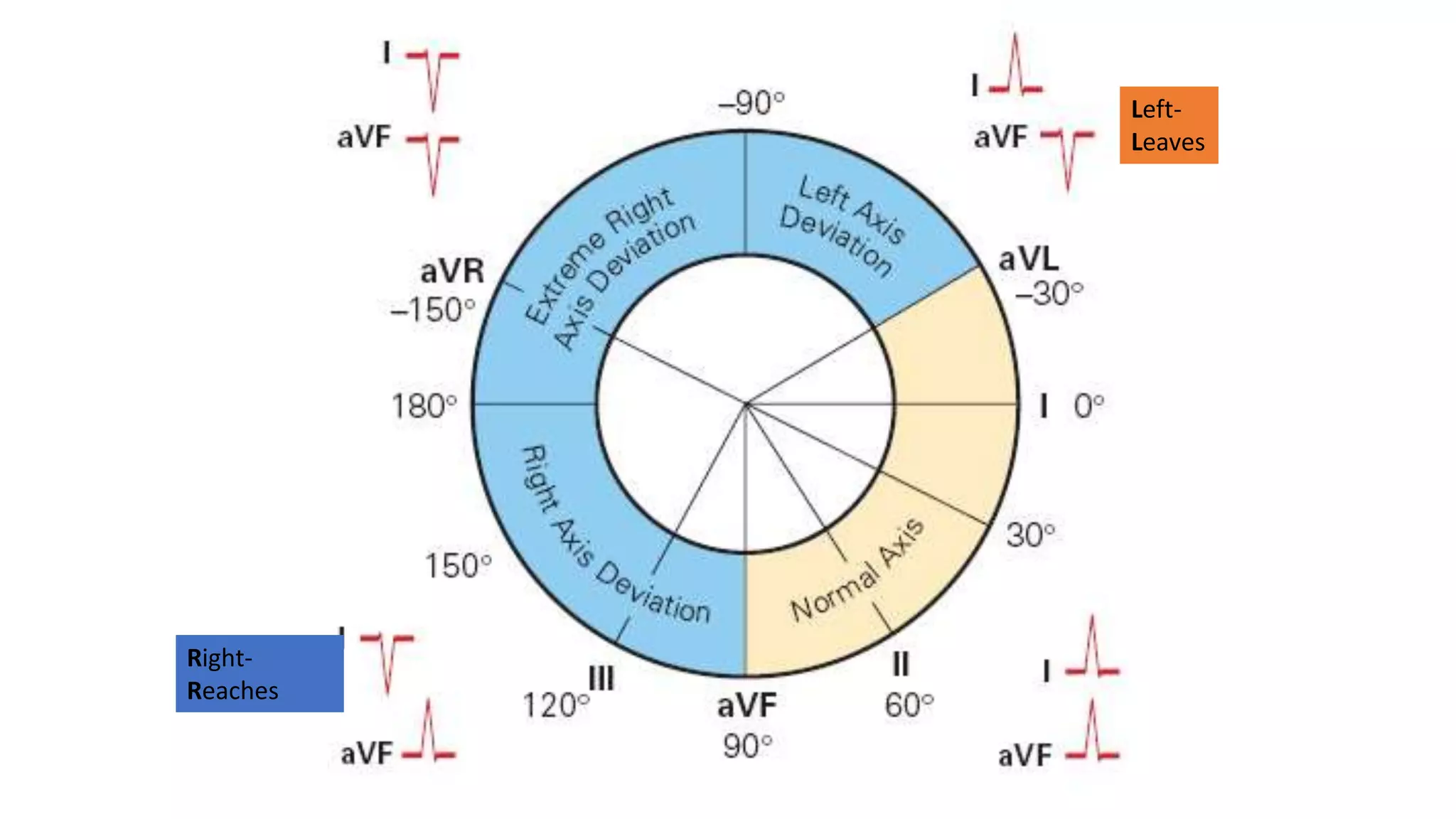 Ecg in children | PPTX