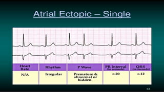 Ecg in children | PPTX