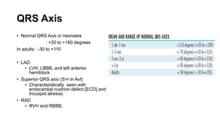 Ecg in children | PPTX