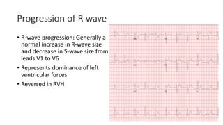 Ecg in children | PPTX