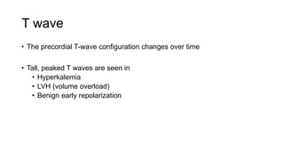 Ecg in children | PPTX