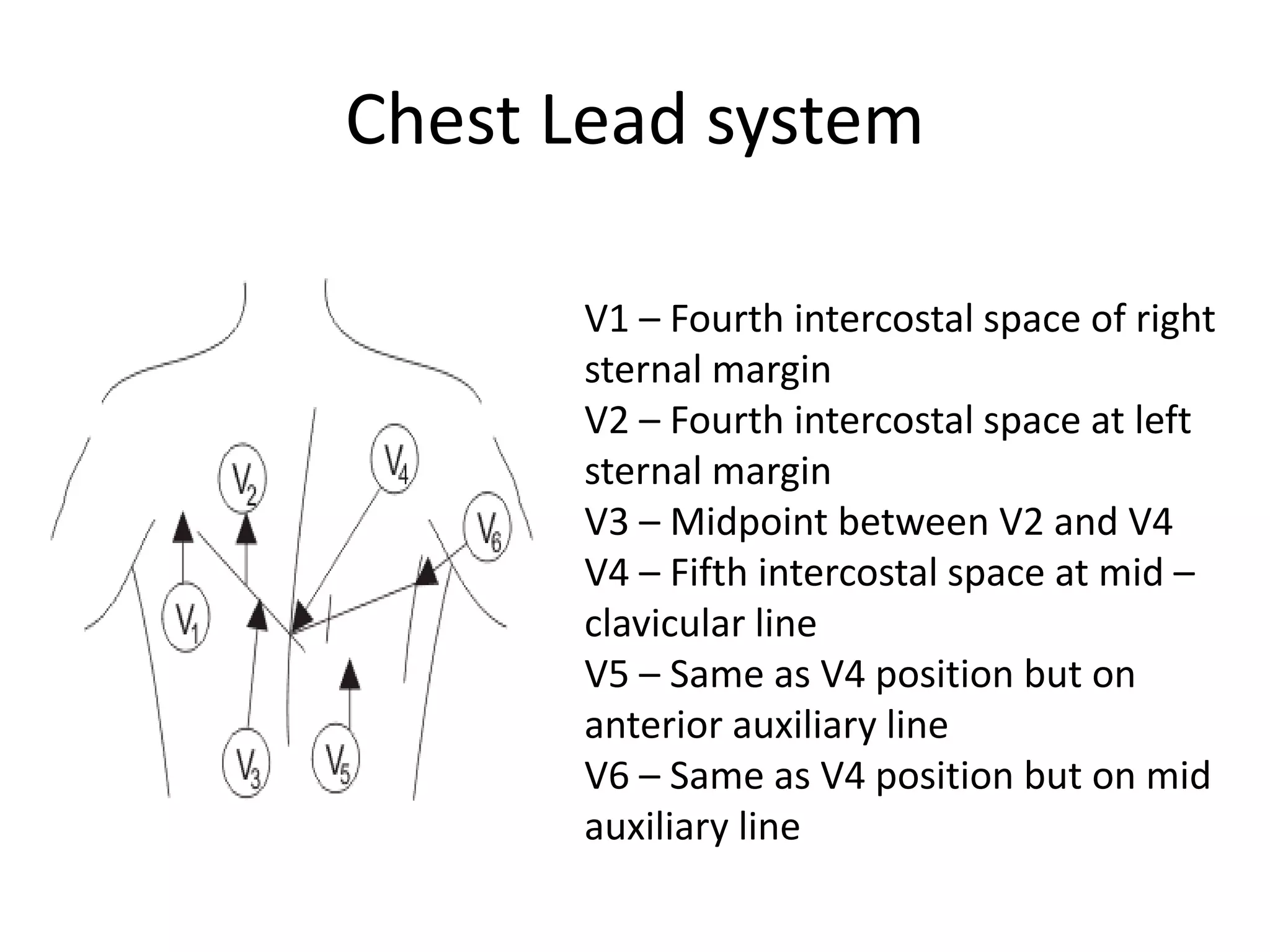 ECG | PPTX
