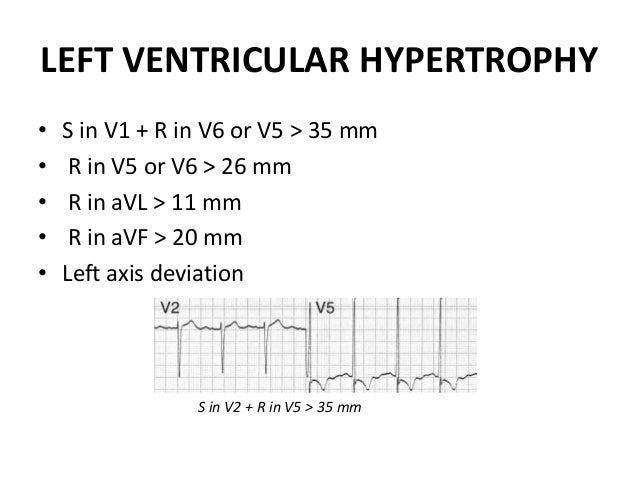 ECG Interpretation