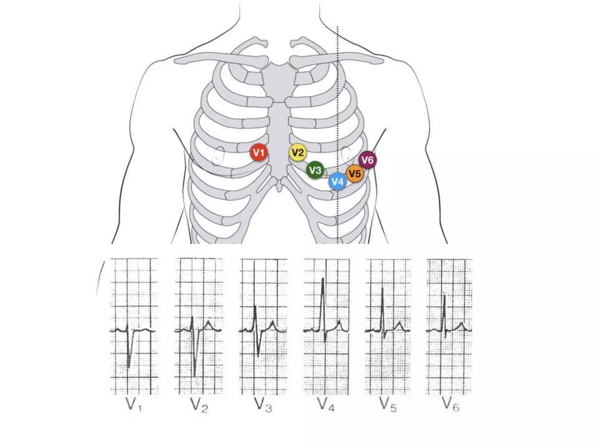 ECG electrocardigram | PPTX | Heart and Cardiovascular Diseases ...