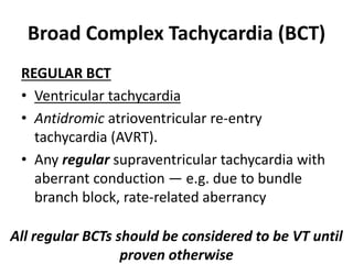 ECG electrocardigram | PPTX