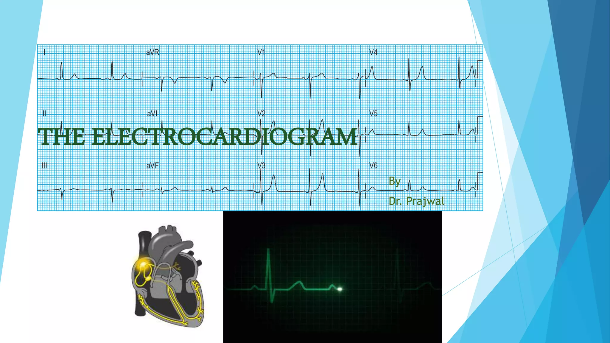 ECG - Electrocardiogram | PPT