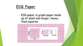 ECG | PPT