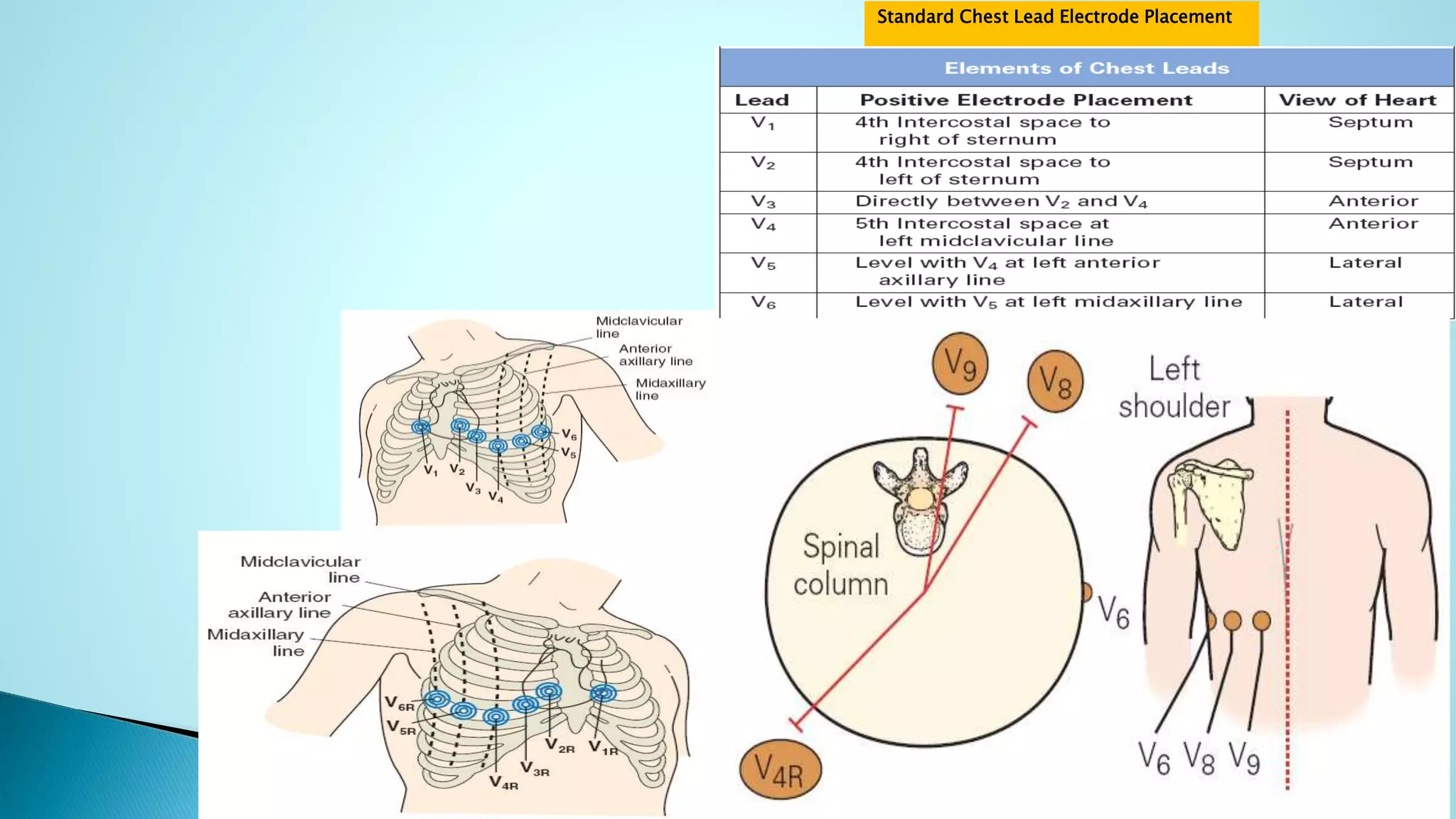 Ecg for beginners | PPTX