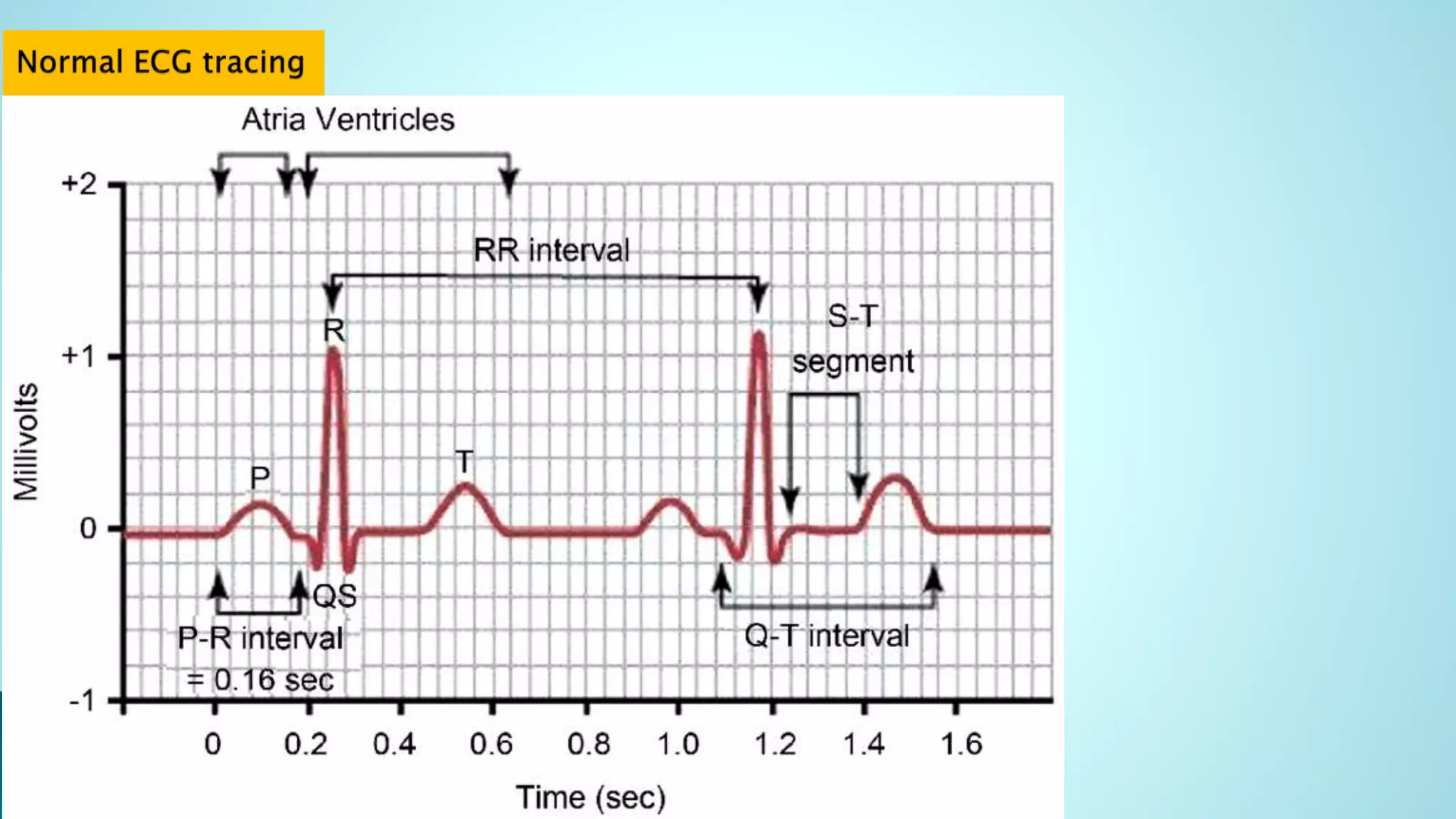 Ecg for beginners | PPTX
