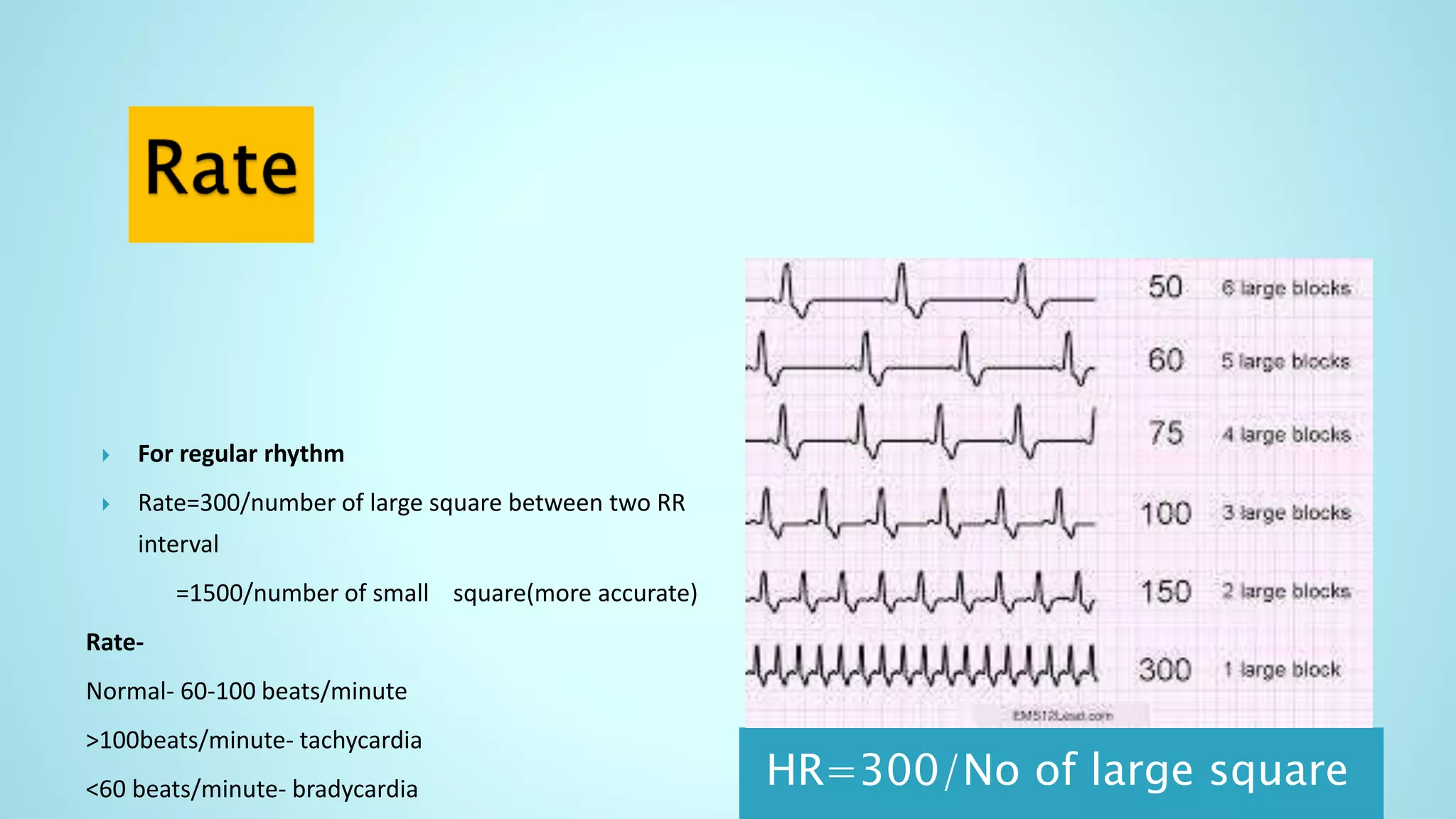 Ecg for beginners | PPTX