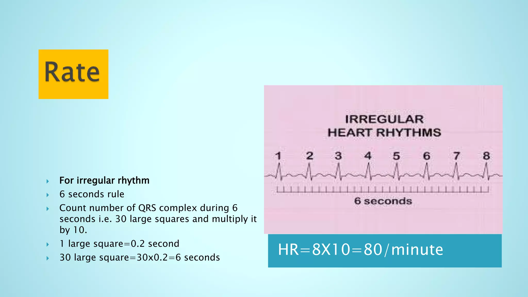 Ecg for beginners | PPTX