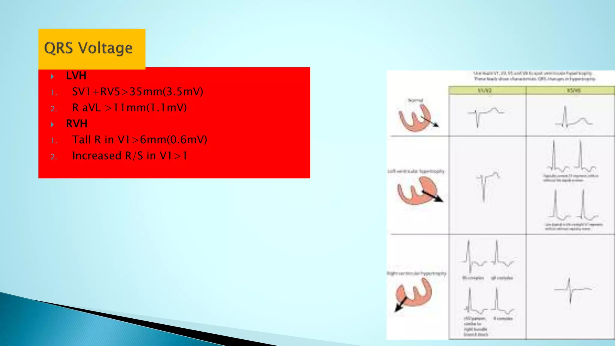 Ecg for beginners | PPTX