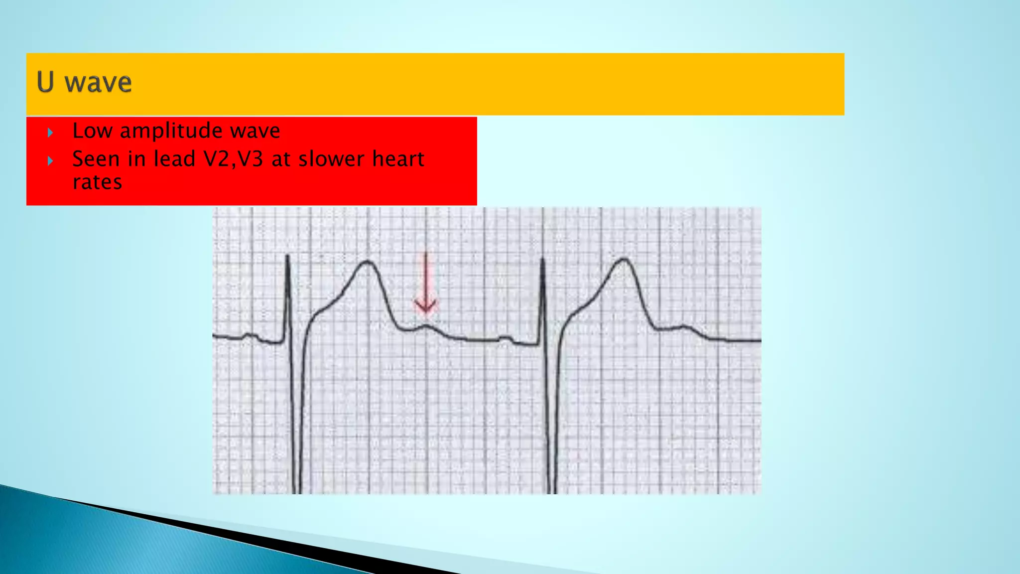 Ecg for beginners | PPTX