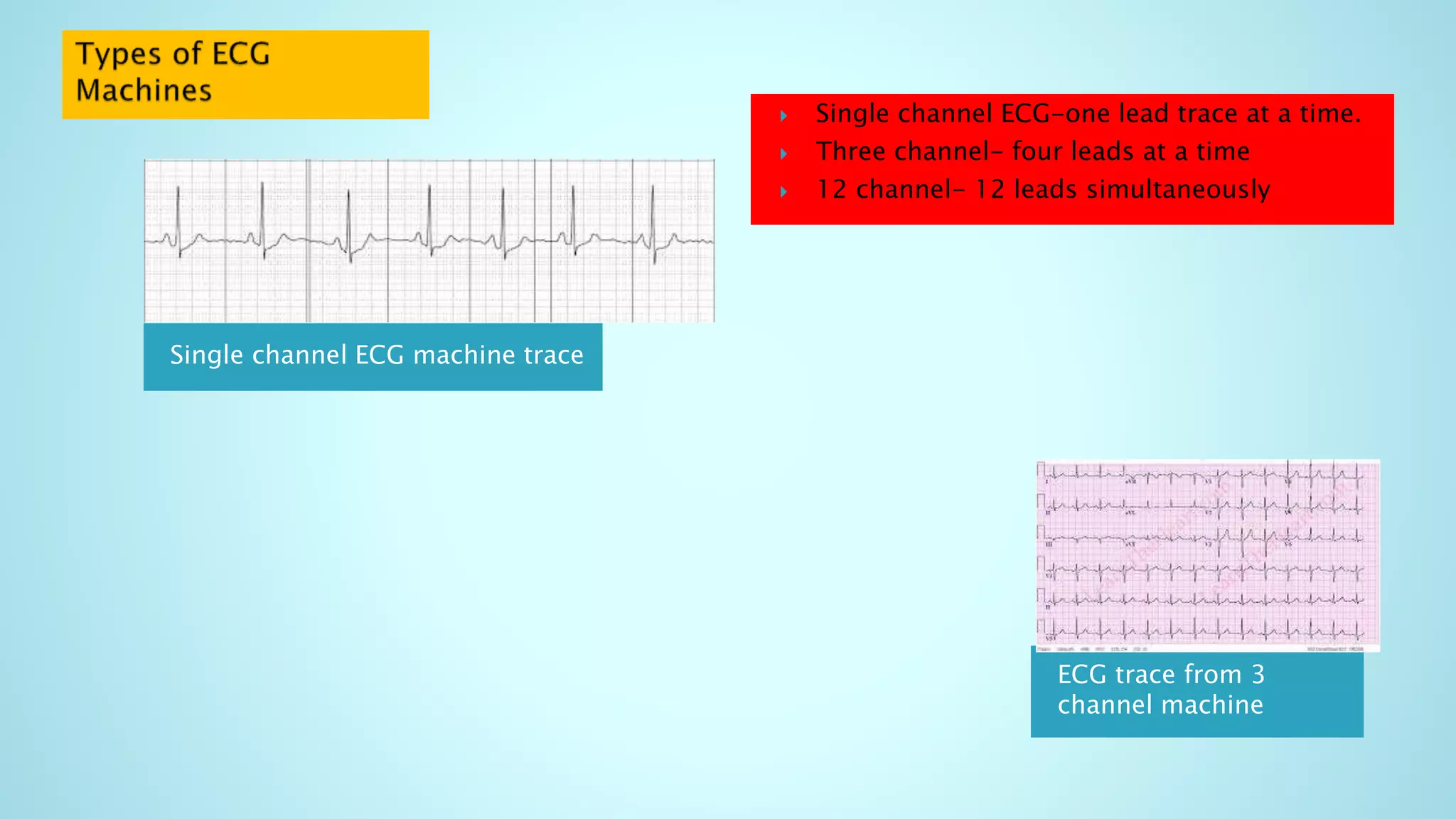 Ecg for beginners | PPTX