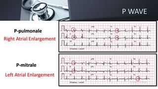 Ecg | PPT