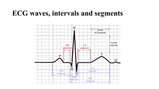 Ecg | PPTX