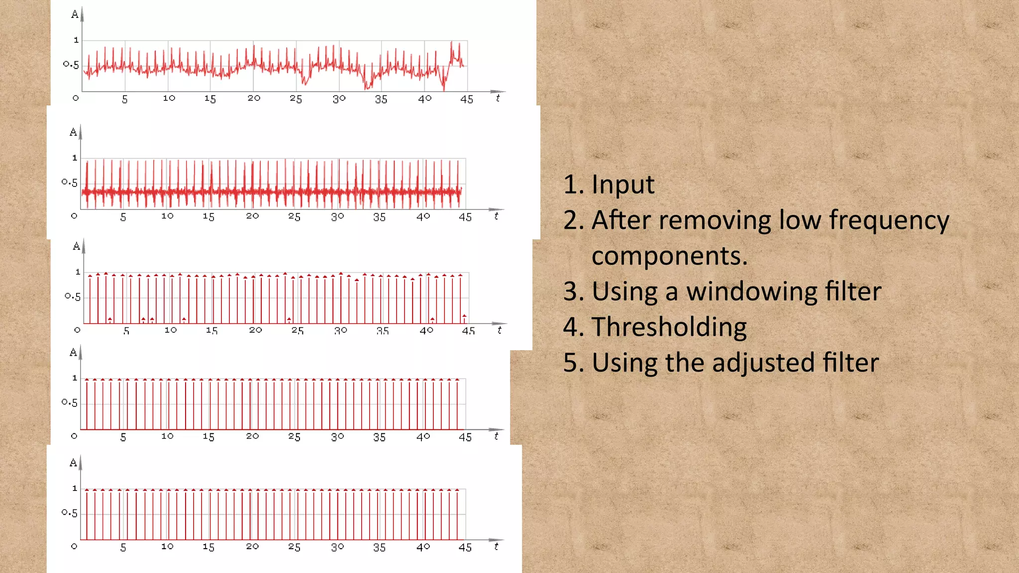 Ecg R Peak Detection | PDF