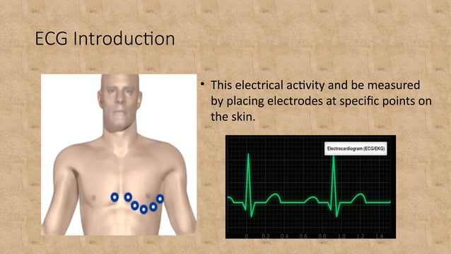 Ecg R Peak Detection Ppt