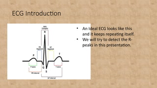 Ecg R Peak Detection | PDF