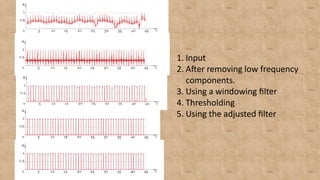Ecg R Peak Detection | PDF