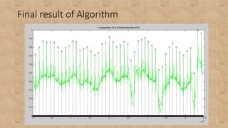 Ecg R Peak Detection | PDF
