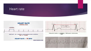 ECG BASICS | PPTX