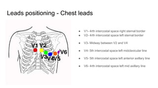 ECG | PPTX | Heart and Cardiovascular Diseases | Diseases and Conditions