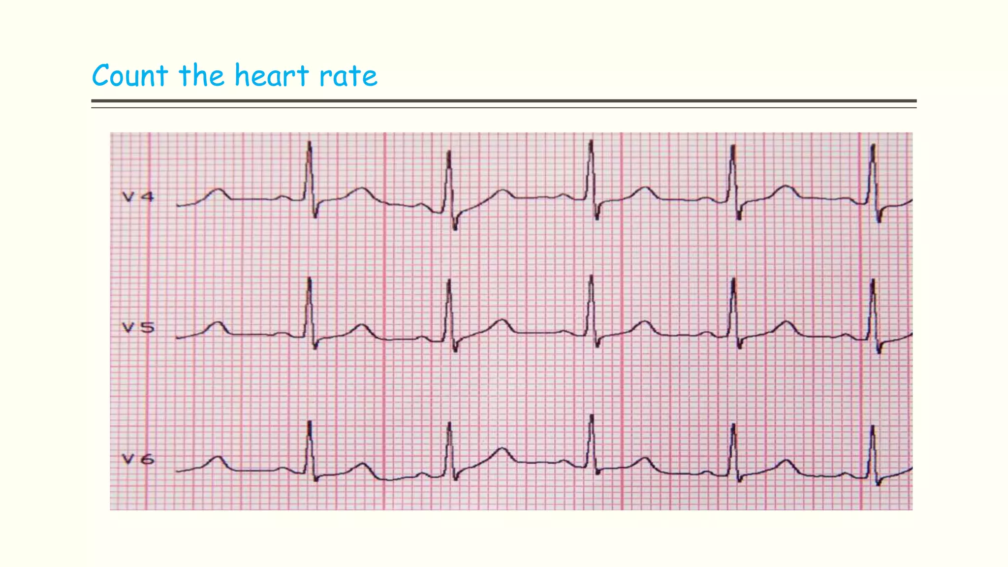 Ecg | PPTX
