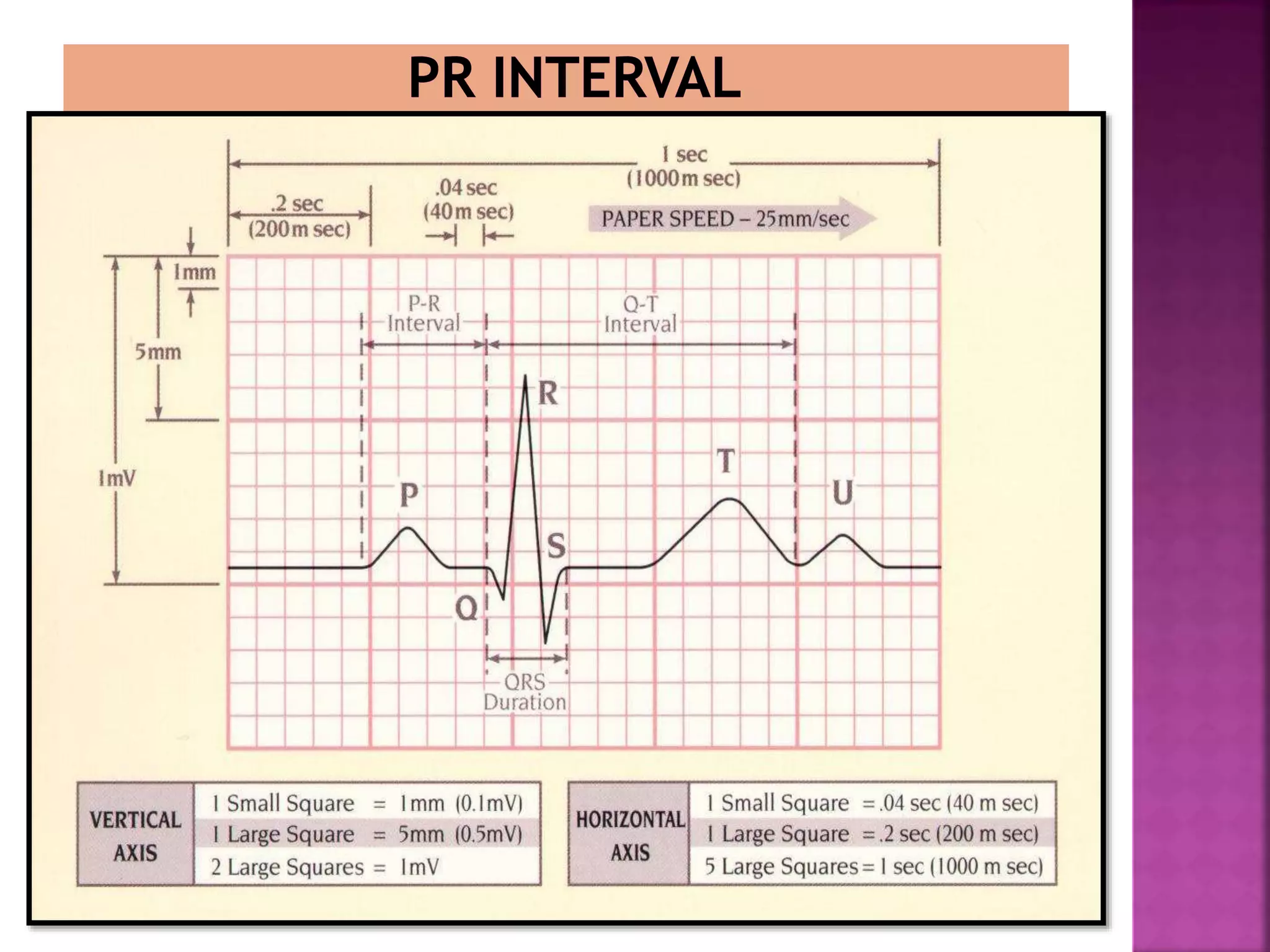 ECG | PPT